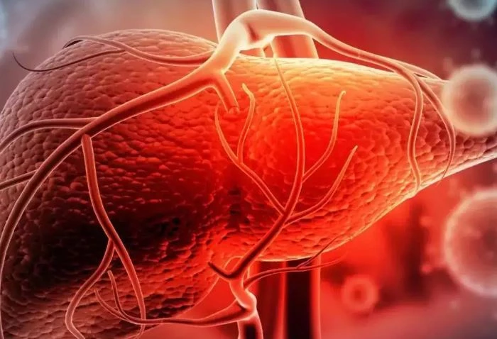 Hơn 3.500 người tử vong mỗi ngày do viêm gan virus