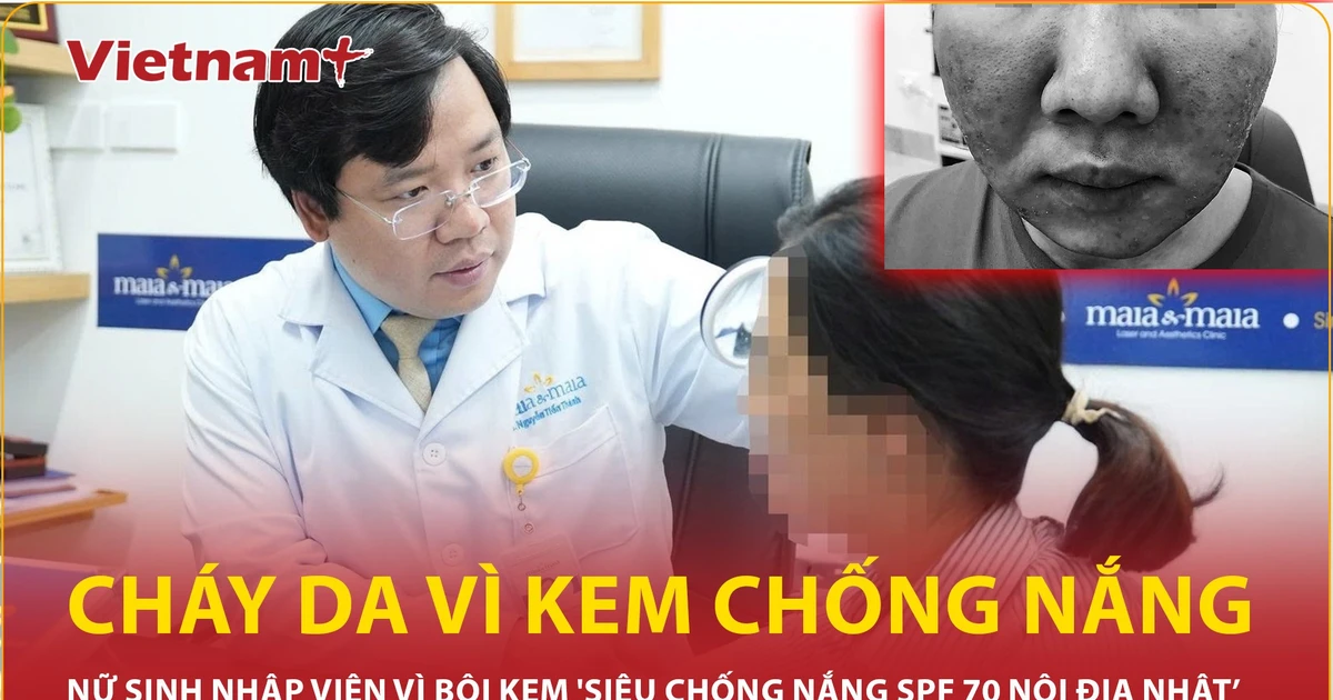Nữ sinh bị bỏng da vì kem chống nắng mua mạng nội địa Nhật