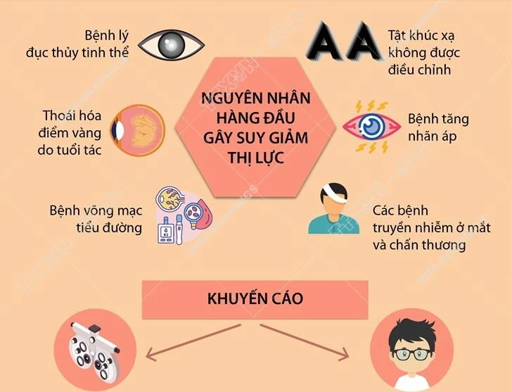 [Infographics] Ngày Thị giác Thế giới: Hãy yêu đôi mắt của bạn ...